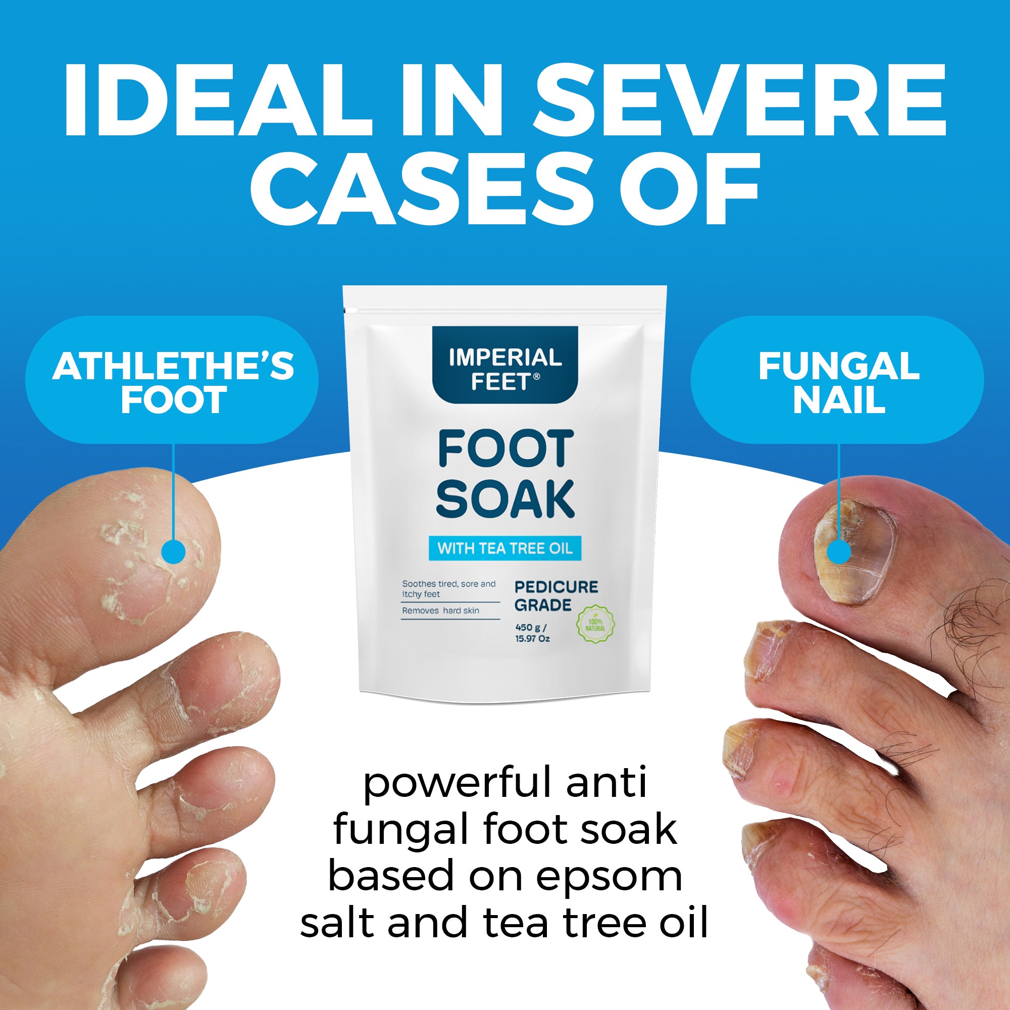 Antifungal foot soak store